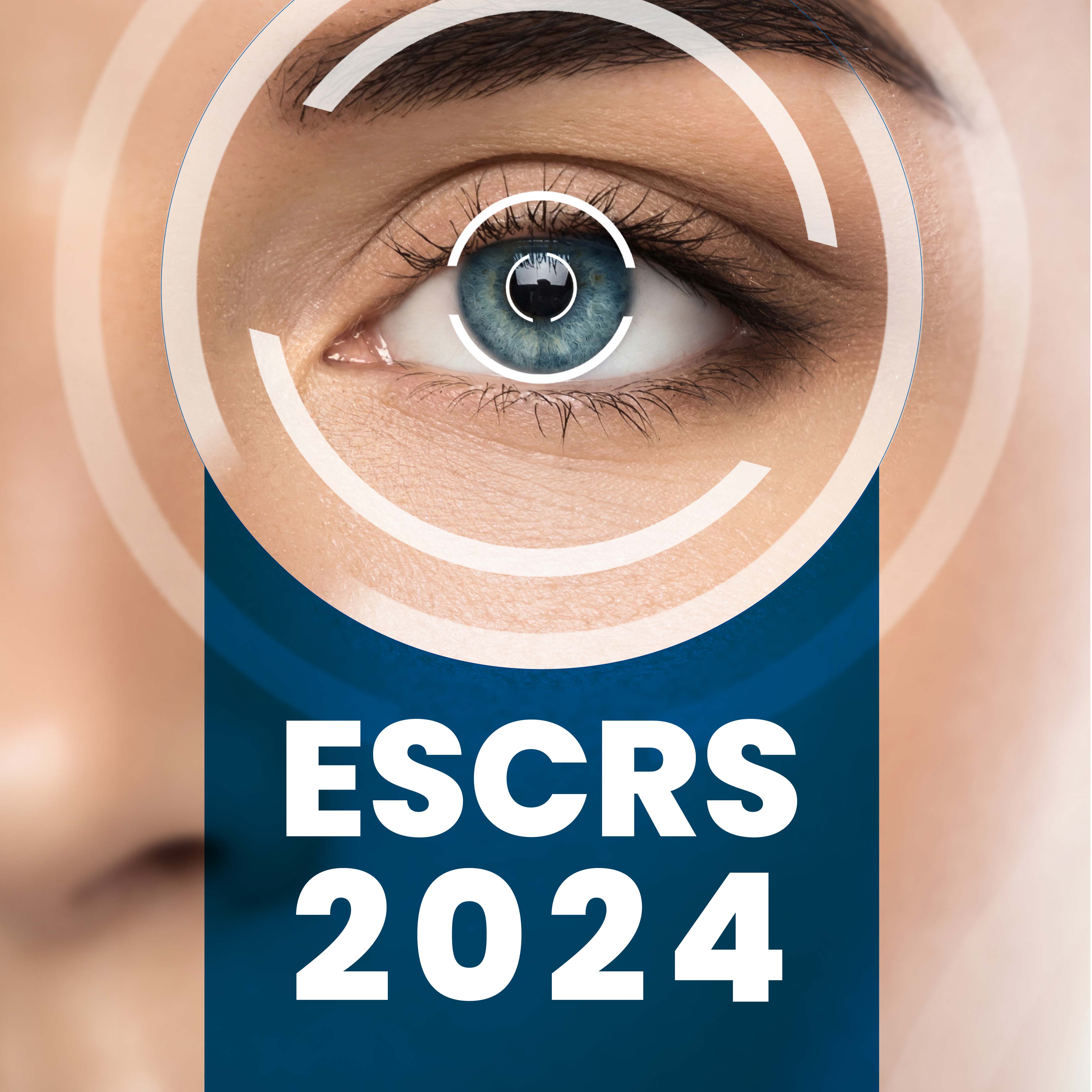 ESCRS 2024: Innovative Glaucoma Surgery - A Guide to New Users: How ...